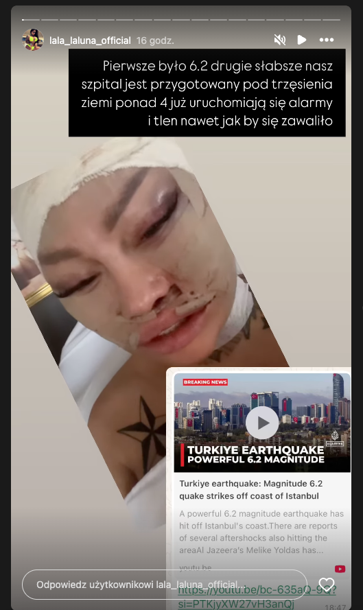 Laluna Unique pokazała rezultaty operacji. Kocie oczy i Barbie baby ...